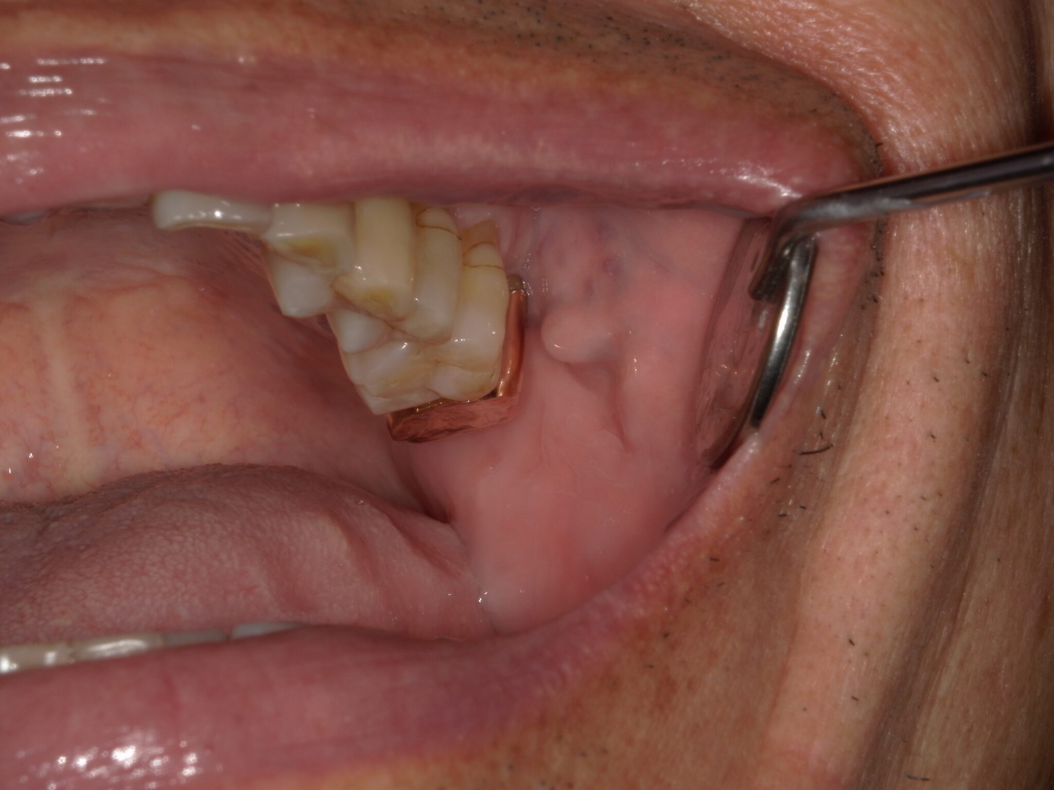 SHOFU DENTAL DIGITAL CAMERA | 尾張旭市の歯医者・にしお歯科こども歯科